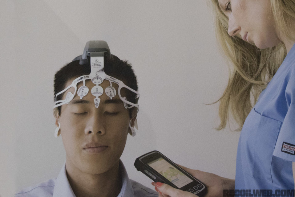 BrainScope - Assessing Traumatic Brain Injury in the Field | RECOIL